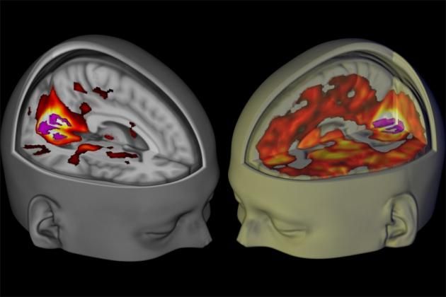 Groundbreaking Study Shows Your Brain (Though Perhaps Not Your Ego) on LSD